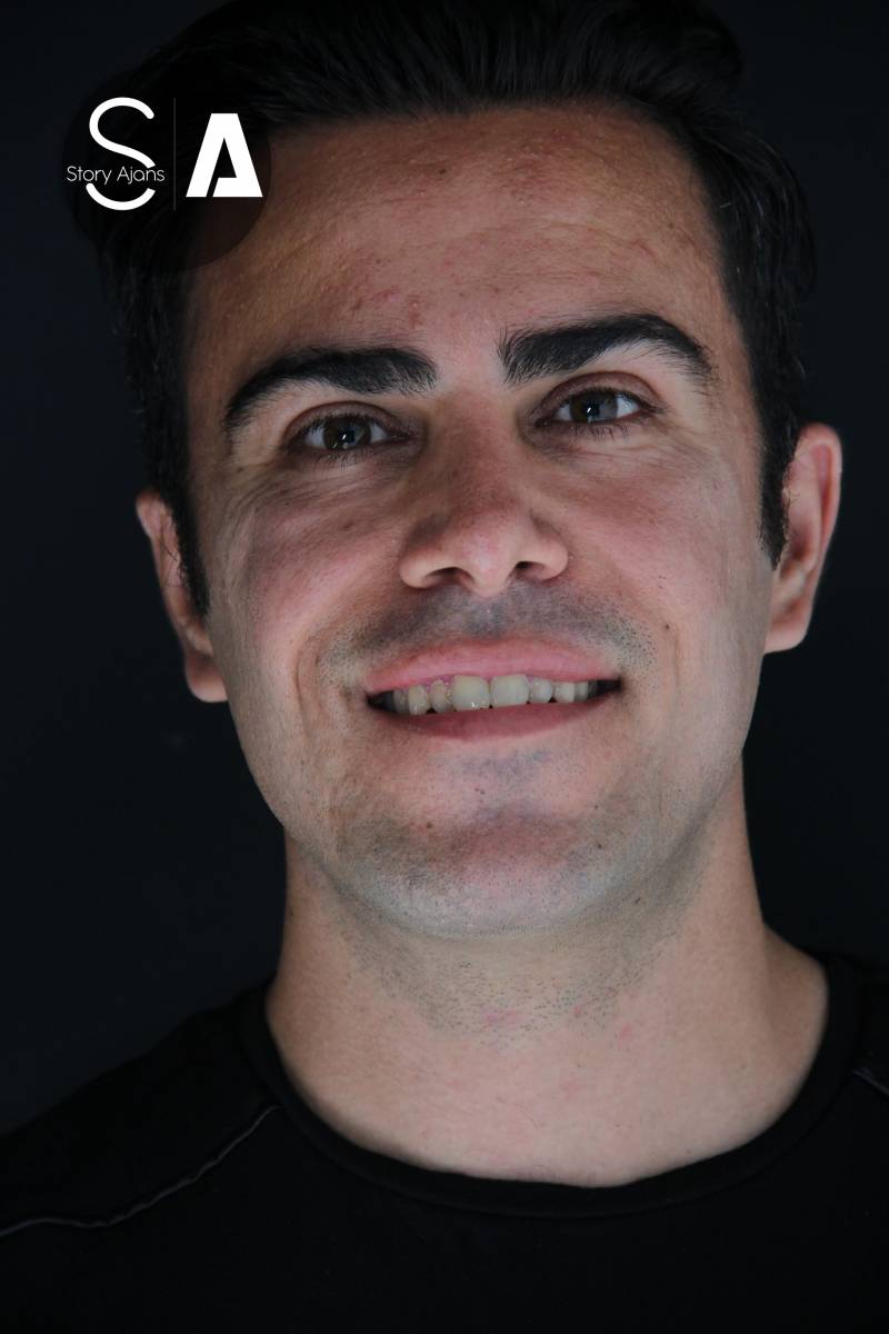 Tolga G. | Story Ajans